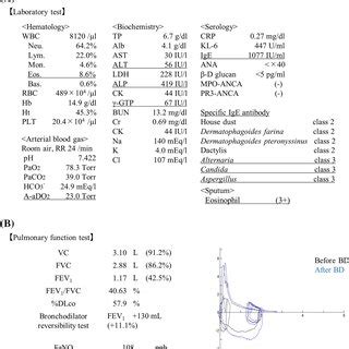 A Laboratory Findings On First Visit B The Findings Of Pulmonary Download Scientific