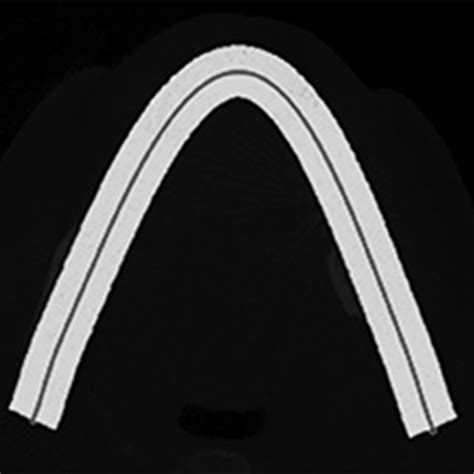 generating panoramic view download scientific diagram