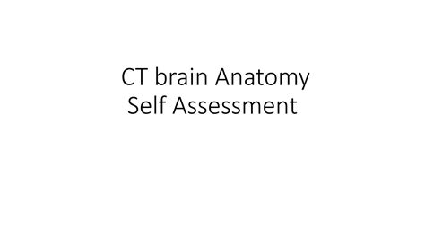 SOLUTION Ct Brain Anatomy Basic Studypool