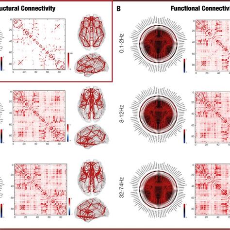 Structural And Functional Whole Brain Connectivity A Structural