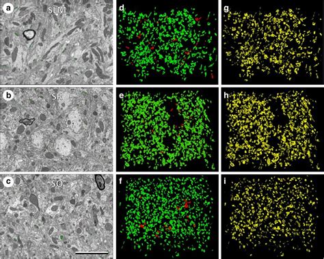 Measuring Synaptic Densities And Sizes In Stacks Of Sections Obtained