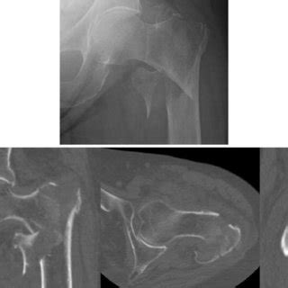 Example Of A Radiograph And CT Scan Download Scientific Diagram
