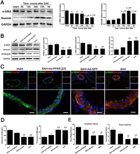 Pparβδ Mediated Cerebral Vsmc Phenotypic Switch And Vascular