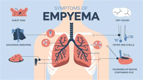 Empyema Causes Symptoms Types Diagnosis And Treatment Science Online