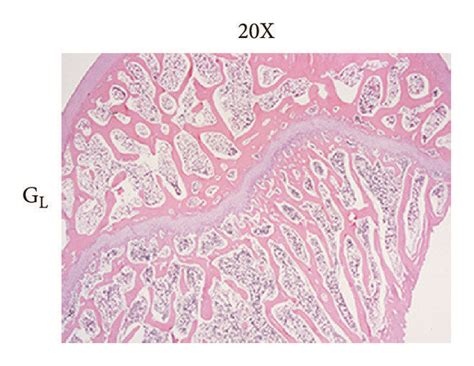 A B Enlarged And Massive Fat Cells And Sparser Trabecular Bone Were Download Scientific