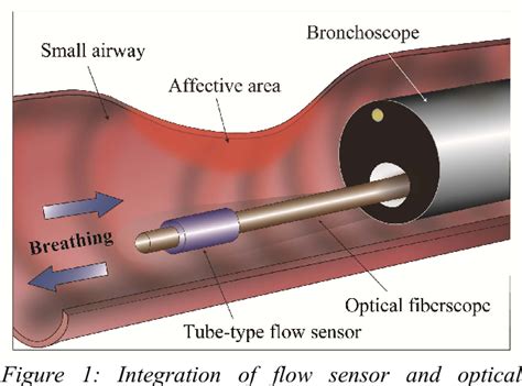 Figure 1 From Integration Of Flow Sensor And Optical Fiberscope For In Situ Breathing And
