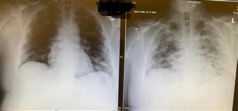 Kapil Dev Chauhan Posted On Linkedin