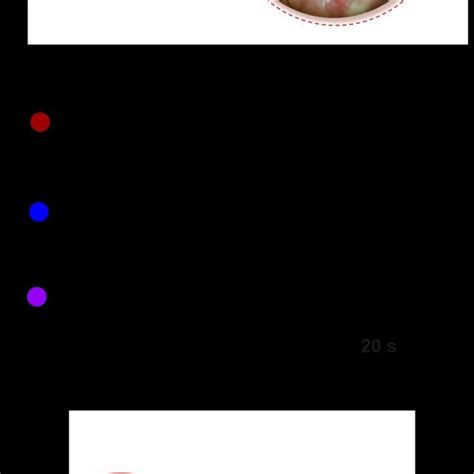 Ecog Recordings From Cerebellum While The Mouse Was On A Treadmill A Download Scientific