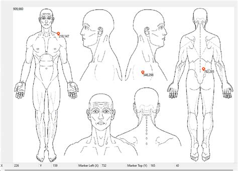 C How To Keep Relative Position Of Timage As A Marker On A Timage