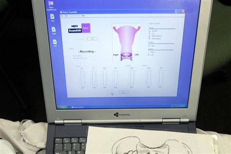 How Pelvic Physio Strives To Take The Pain Out Of Sex The Globe And Mail