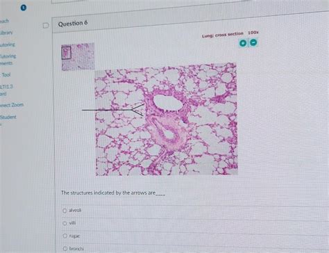 Solved The structures indicated by the arrows are alveoli | Chegg.com