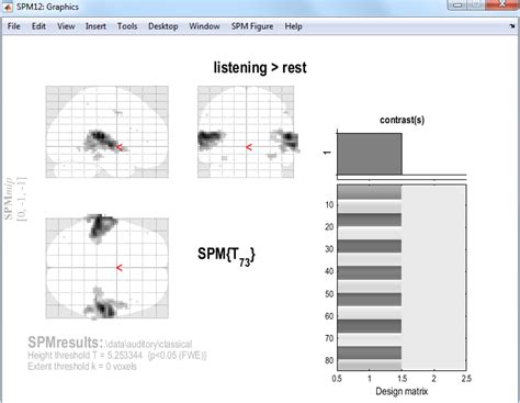 First Level Modelling Block Design Spm Documentation