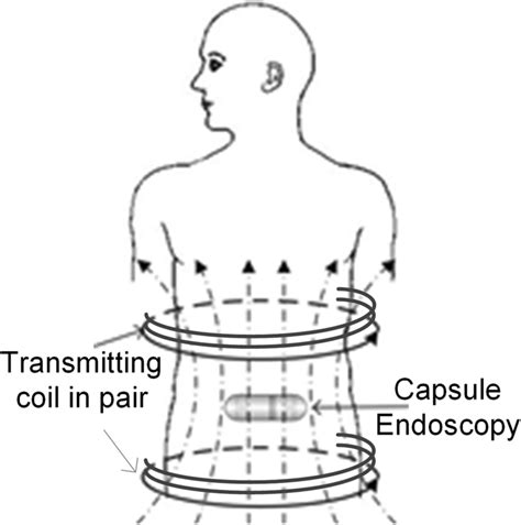 Work Mode Of Wireless Capsule Endoscopy Wce Download Scientific Diagram