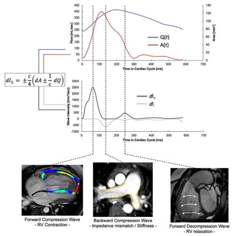 Wave Intensity Analysis Spectrum Sampled At The Main Pulmonary Mid Download Scientific Diagram