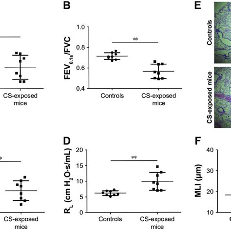 Lung Function And Histological Measurements In Controls And Cs Exposed