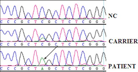 Mutation Analysis Sequence Data Sequence Chromatogram Of A Normal Download Scientific Diagram