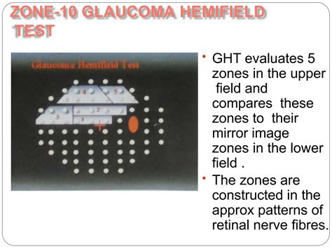 Automated Perimetry Humphreys Visual Fieldpptx