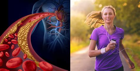 Coronary Artery Disease Natural Ways To Help Relieve Cad Symptoms