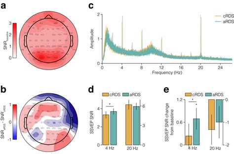 Steady State Visually Evoked Potential Ssvep In Response To The Test