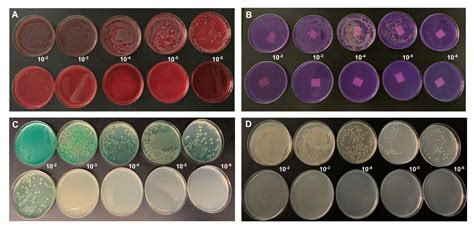 Video Author Spotlight An Antimicrobial Fabric Using Nano Herbal Encapsulation Of Essential Oils