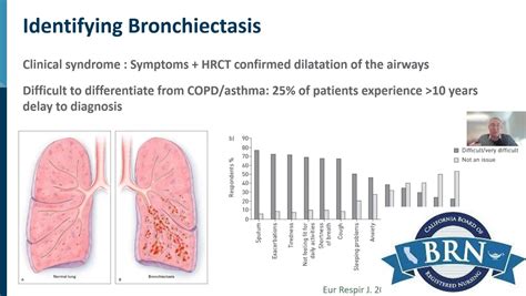 Nursing Course 17 Exploring The Vicious Vortex And Treatment