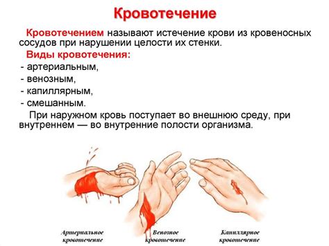 Кровотечение картинки 46 фото