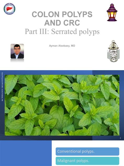 Colon Polyps And Crc Part Iii Serrated Polyp 2021 Pdf Colorectal
