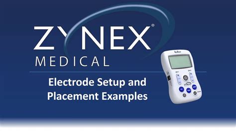 Nmes Electrode Placement Chart A Visual Reference Of Charts Chart Master