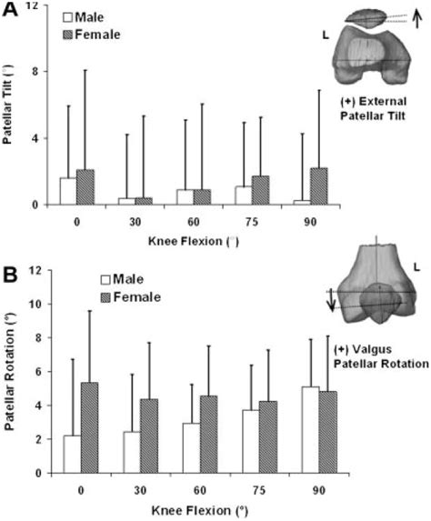 Patellar Tendon Orientation And Patellar Tracking In Male And Female