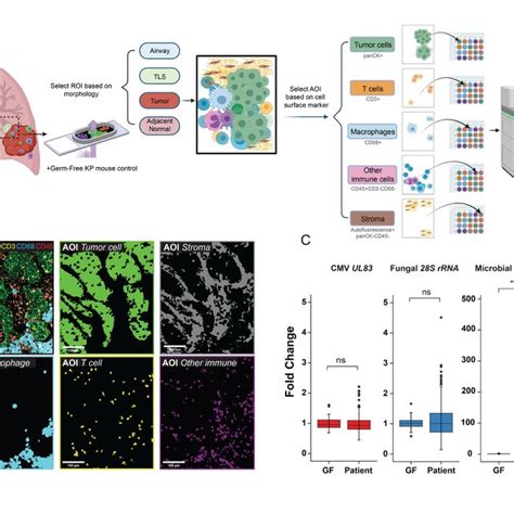 Spatial Meta Transcriptomic Analysis Of Lung Cancers A Study Scheme Download Scientific