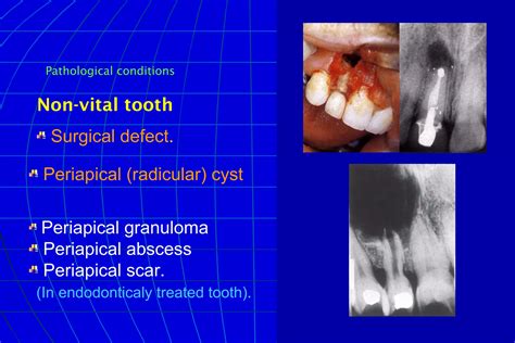 Oral Radiology Intro Differential Diagnosis Ppt