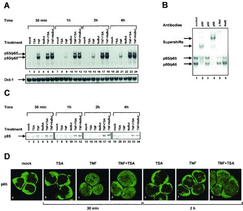 Sustained Nf B Binding To Dna After Tnf Tsa Nabut Versus Tnf