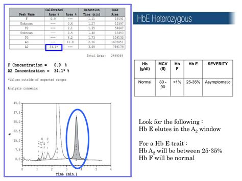 High Performance Liquid Chromatography Interpretation Ppt