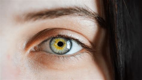 Managing Glaucoma Early Detection And Treatment Clairevision Eye Hospital