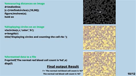 microscopic image analysis for cell counting using matlab pdf