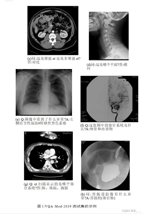 深度学习神经网络学习笔记 多模态方向 06 Vqa Med Overview Of The Medical Visual Question