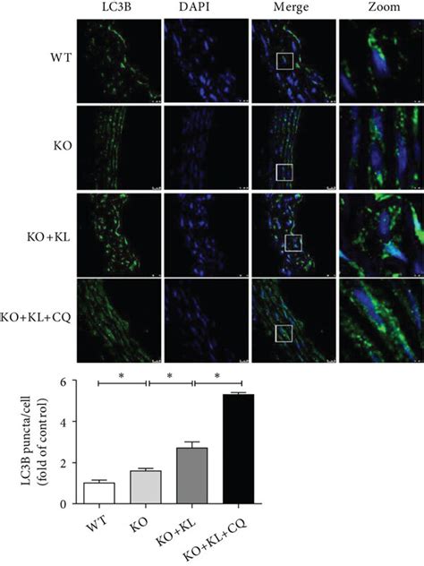 Klotho Ameliorates Aortic Vc By Promoting Autophagy In Klotho Deficient Download Scientific