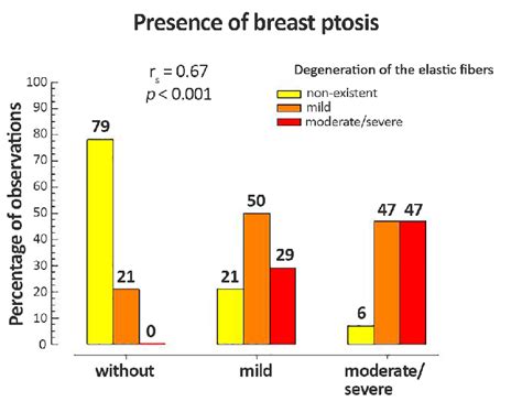 Correlation Between Ptosis And Degeneration Of Elastic Fibers Elastic