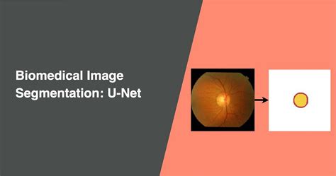 Biomedical Image Segmentation U Net By Jingles Hong Jing Tds Archive Medium