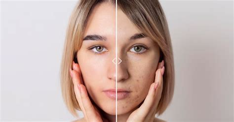 WP Before After Image Slider Multilingual Code Canel