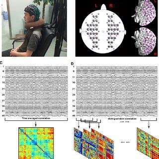 PDF Dynamic Functional Connectivity Revealed By Resting State Functional Near Infrared