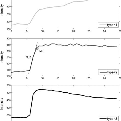 Parameters Related To The Time Intensity Curve Type Slope Of Download Scientific Diagram
