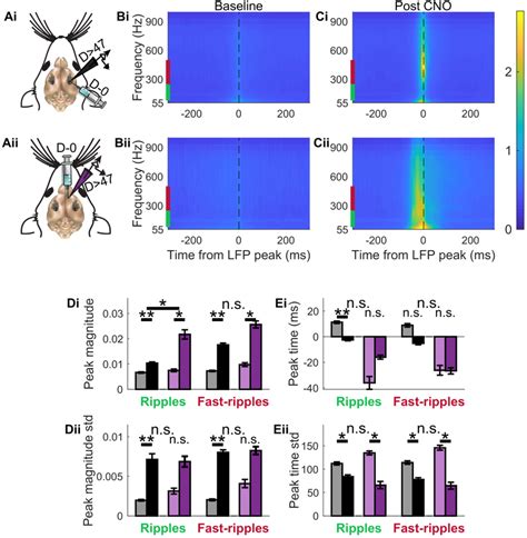 wavelet analysis of spontaneous focus epileptiform events download