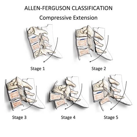 Allen Ferguson Classification For Ivan Lvov Md Phd Facebook