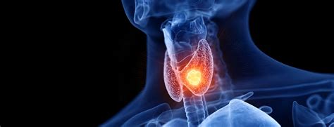 Thyroid And Parathyroid Gland Cancer Treatment In Jaipur India