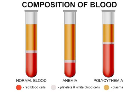 Composición del concepto de sangre aislado sobre fondo blanco. | Foto ...