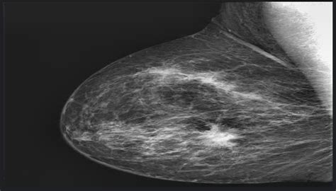 FPGA实现CLAHE算法 Verilog 知乎