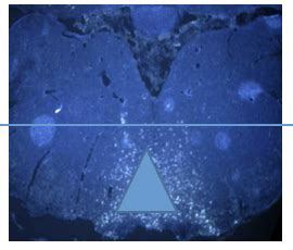 Lecture 6 Descending Control I Flashcards Quizlet
