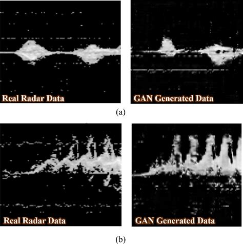 Figure 10 From Machine Learning For Healthcare Radars Recent