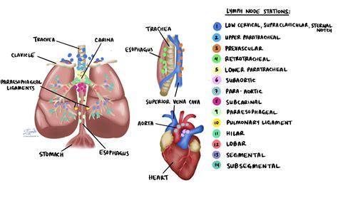 Non Keratinizing Squamous Cell Carcinoma Of The Lung Mypathologyreport Ca